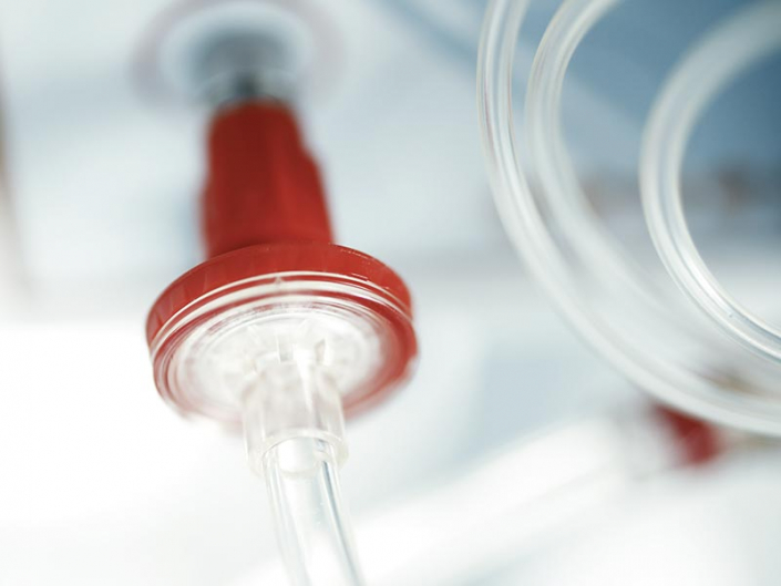 Apherese bei Macula-Degeneration